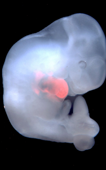 Scientists create a part-human, part-pig embryo — raising the ...